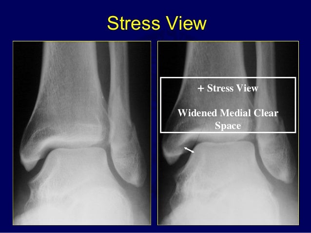 Lecture trauma ankle_tendon
