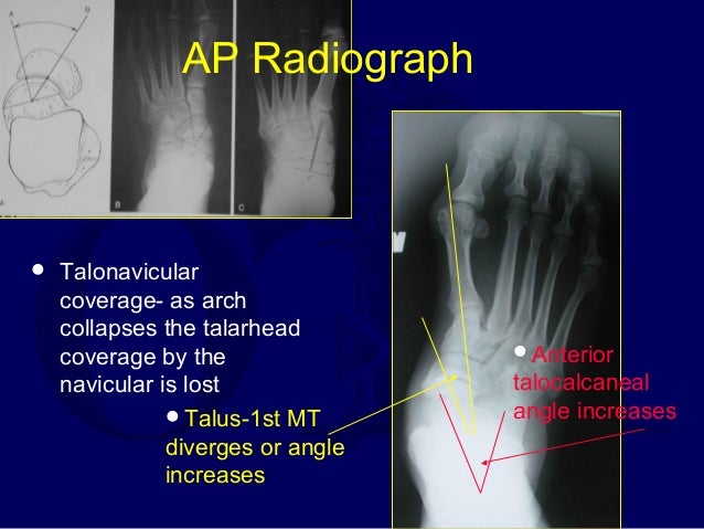 Lecture trauma ankle_tendon
