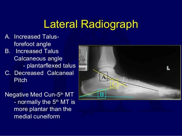 Lecture trauma ankle_tendon