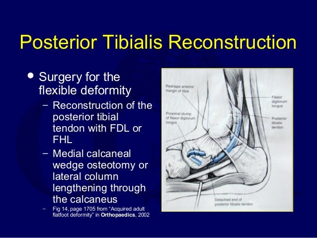 Lecture trauma ankle_tendon