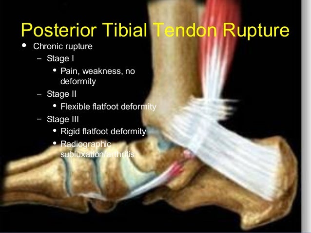 Lecture trauma ankle_tendon