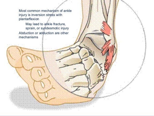 Lecture trauma ankle_tendon