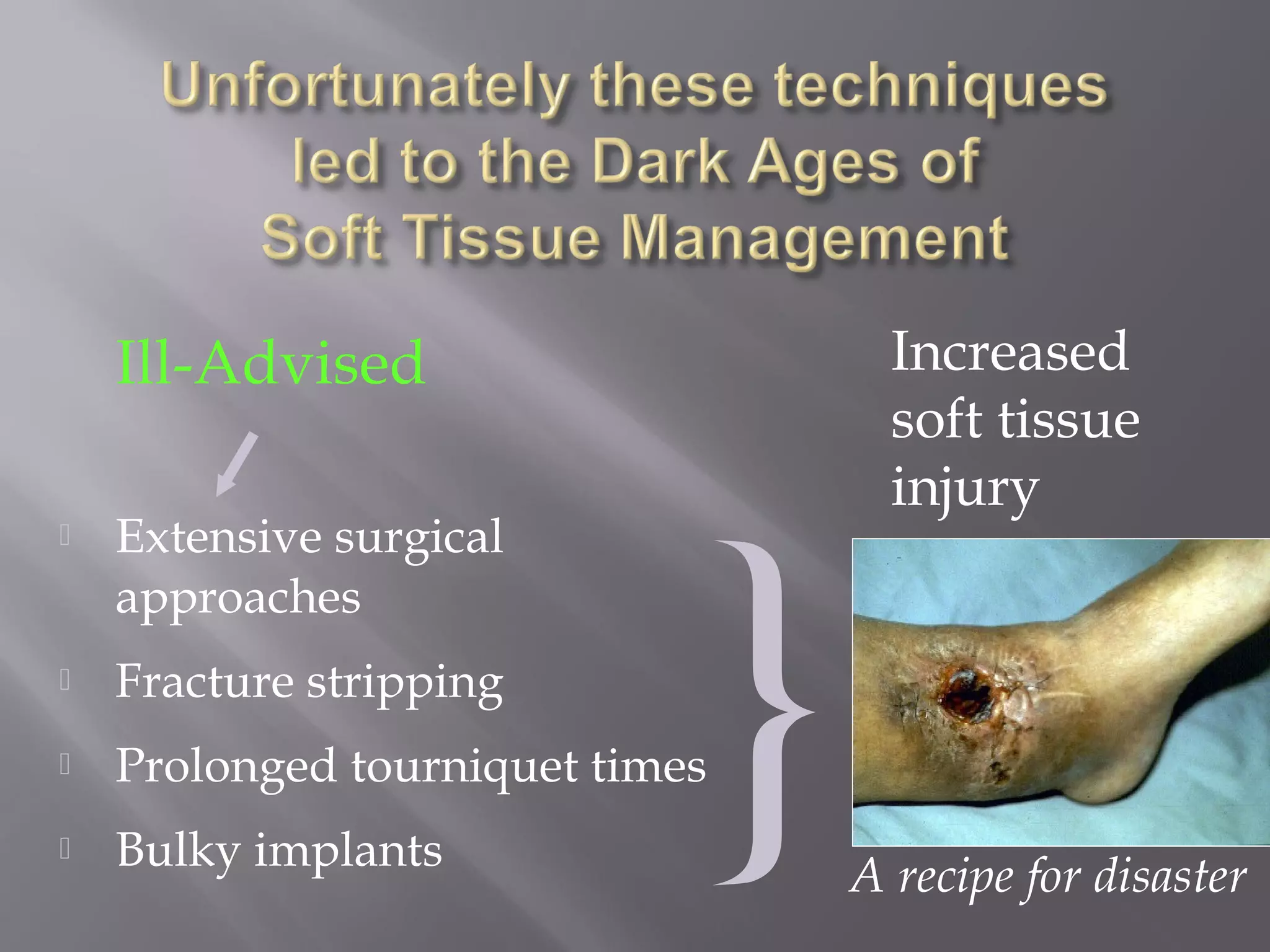 Lecture ucmc pilon plafond fracture distal tibia | PPT | Death, Injury ...