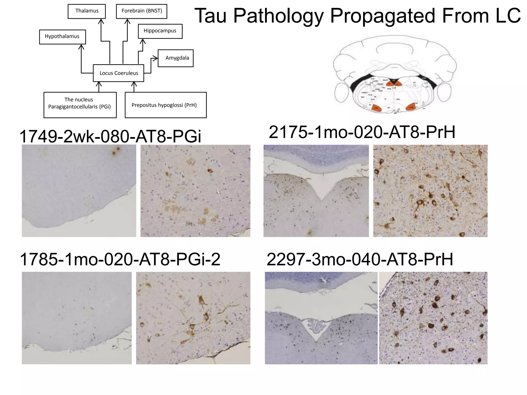 Virginia Lee - Cell-to-Cell Spread of Pathological Tau | PPT