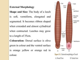 Leeches Diagram