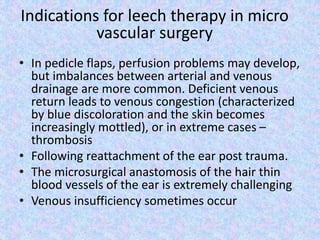 Leech therapy | PPTX