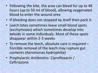 Leech therapy | PPTX