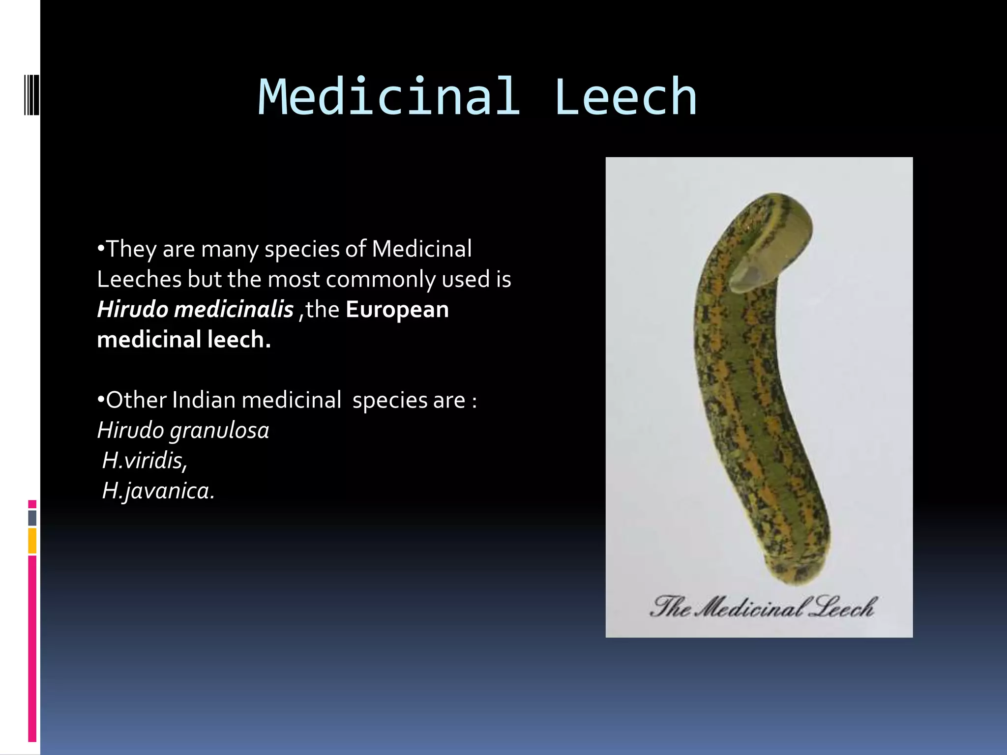 Irsal e Alaq (Leech Therapy) | PPT