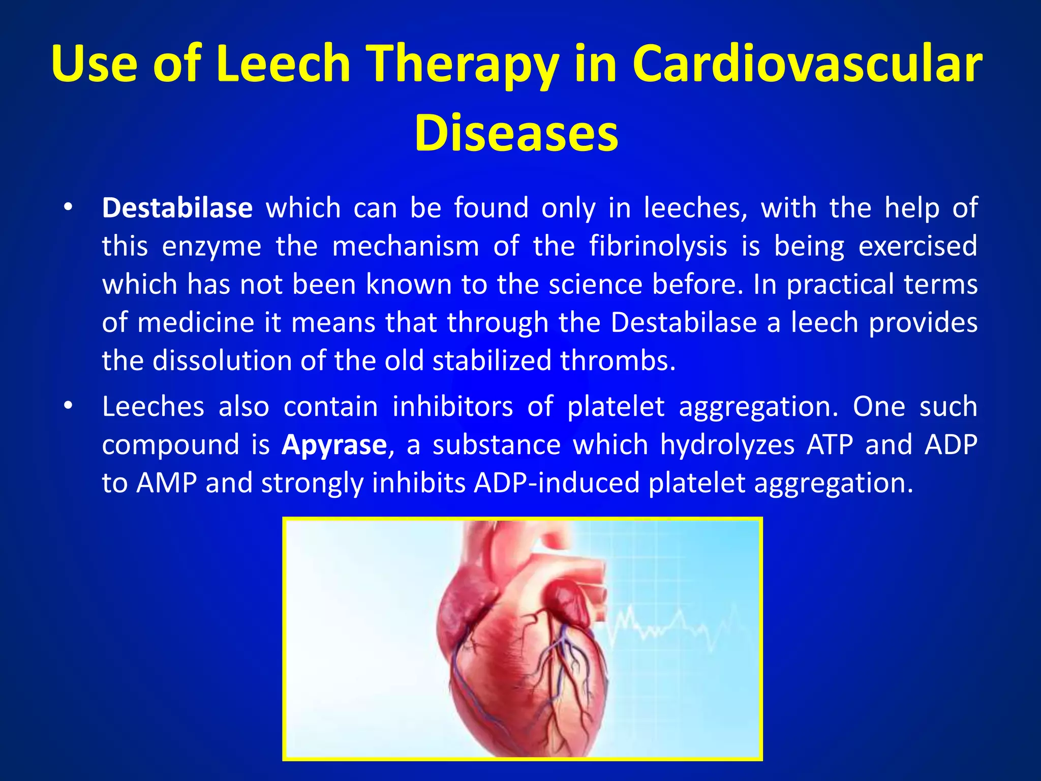 Leech therapy by Dr.M.A.Lateef Siddiqui. | PPTX