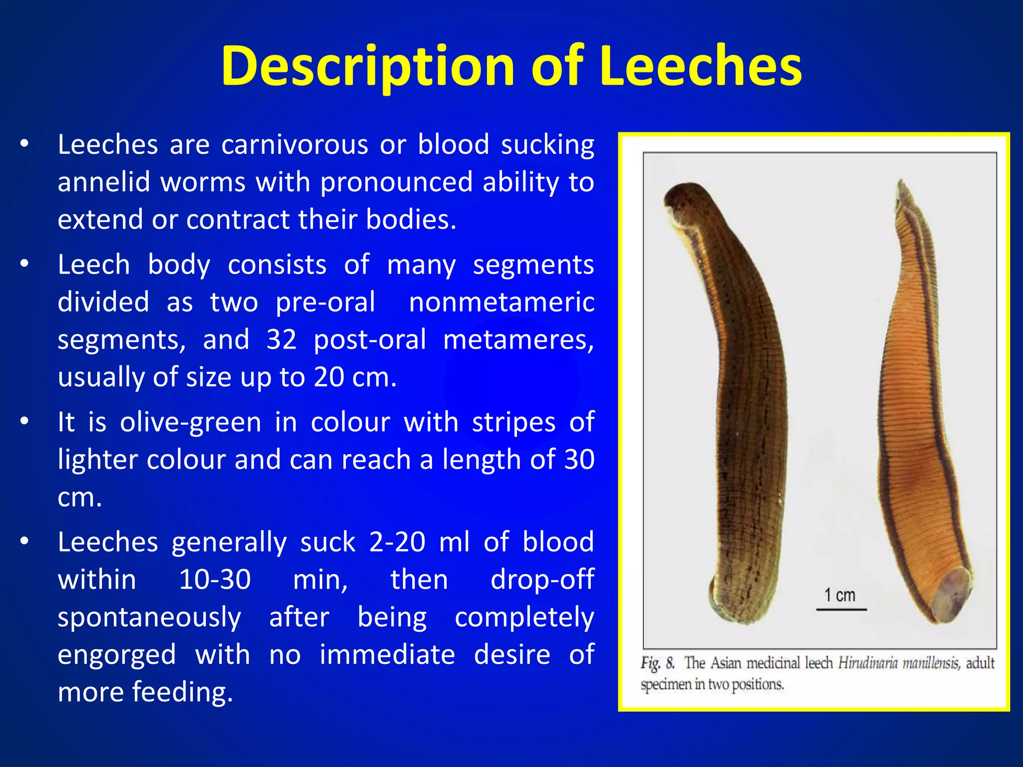 Leech therapy by Dr.M.A.Lateef Siddiqui. | PPTX