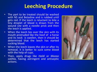 Leech Therapy