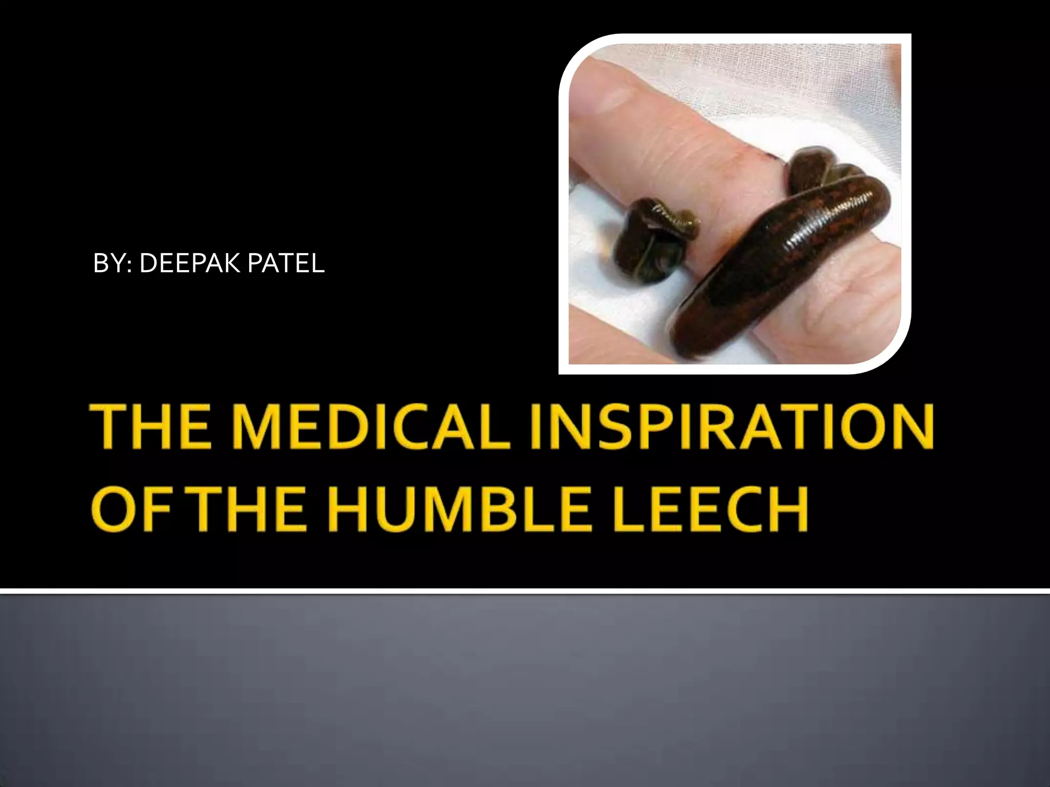 LEECH THERAPY | PPTX