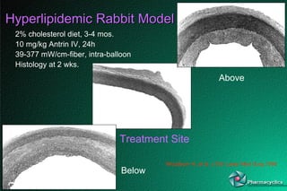 Antrin (motexafin lutetium) photoangioplasty | PPT