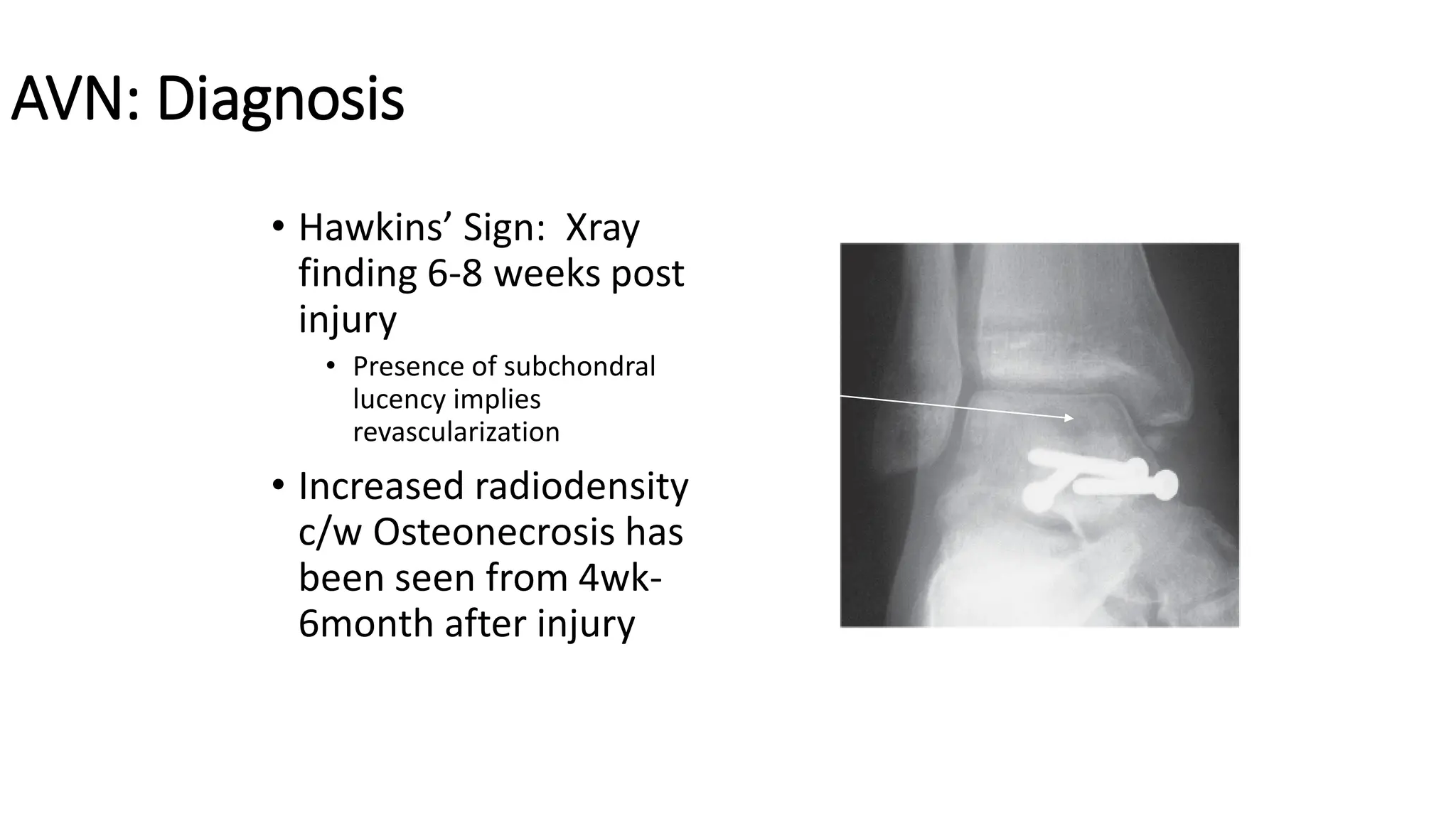 LE F&A4 Fractures and Dislocation of the Talus.pdf