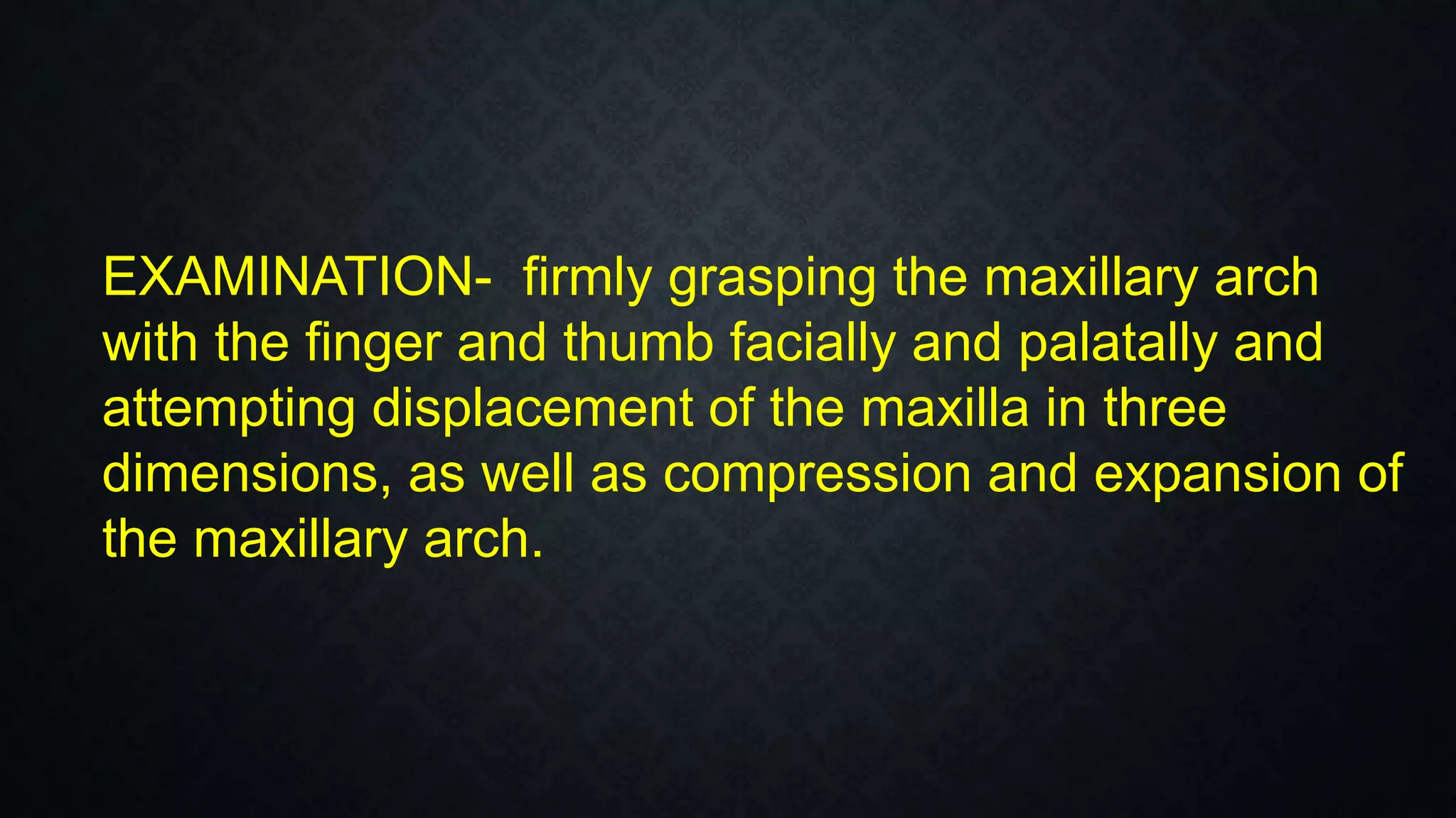 Lefort 1 fracture | PPTX