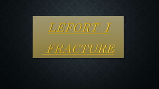 Lefort 1 fracture | PPTX