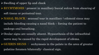 Lefort 1 fracture | PPTX