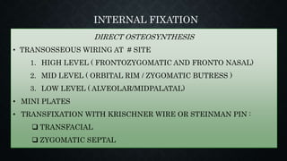 Lefort 1 fracture | PPTX