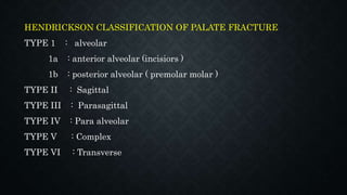 Lefort 1 fracture | PPTX