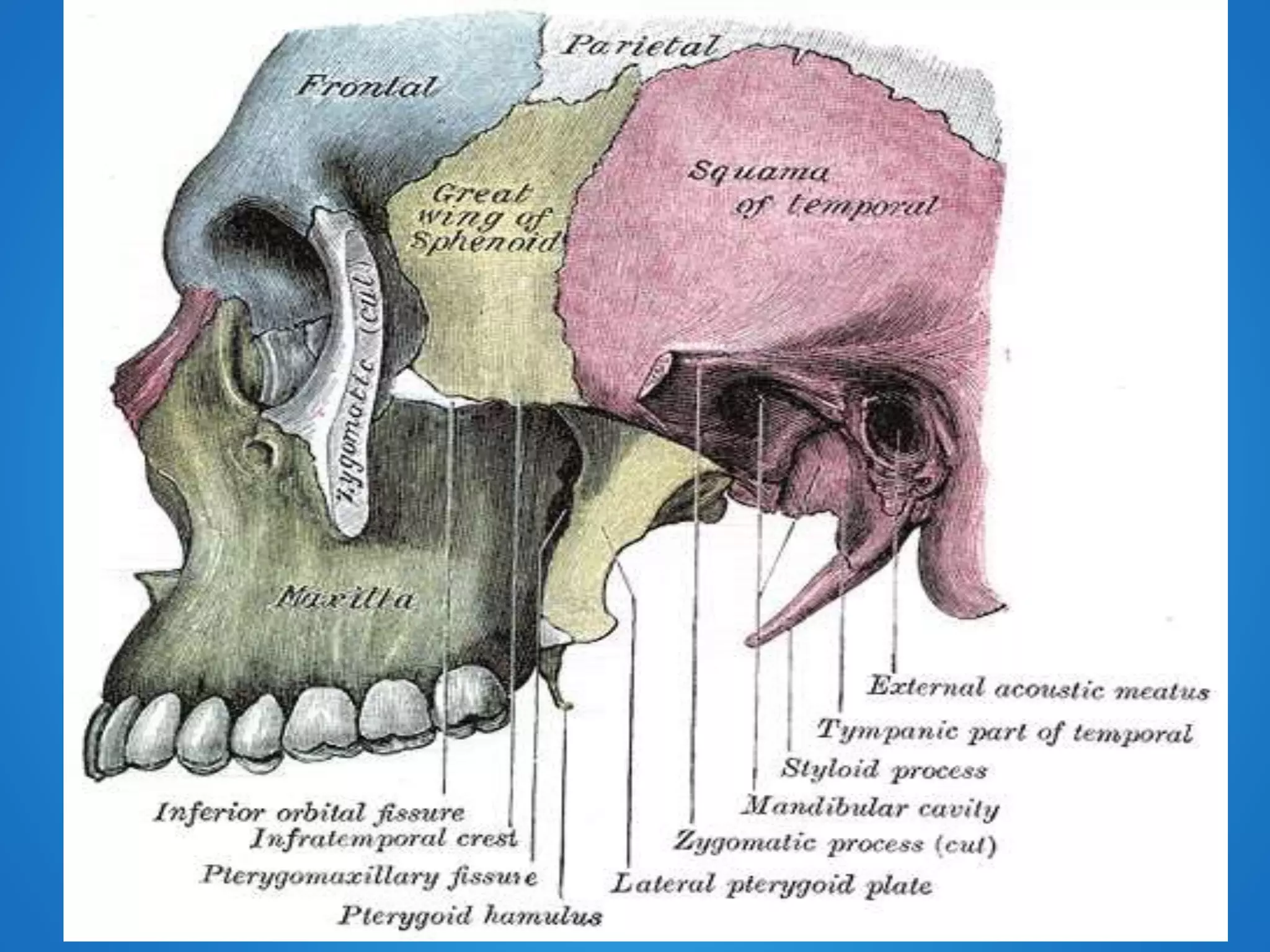 Lefort 1 osteotomy | PPTX
