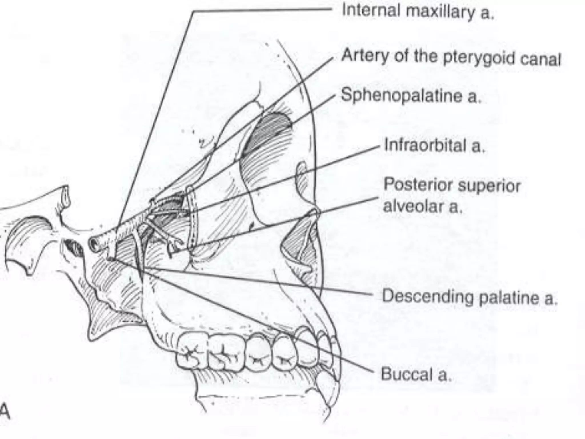 Lefort 1 osteotomy | PPTX