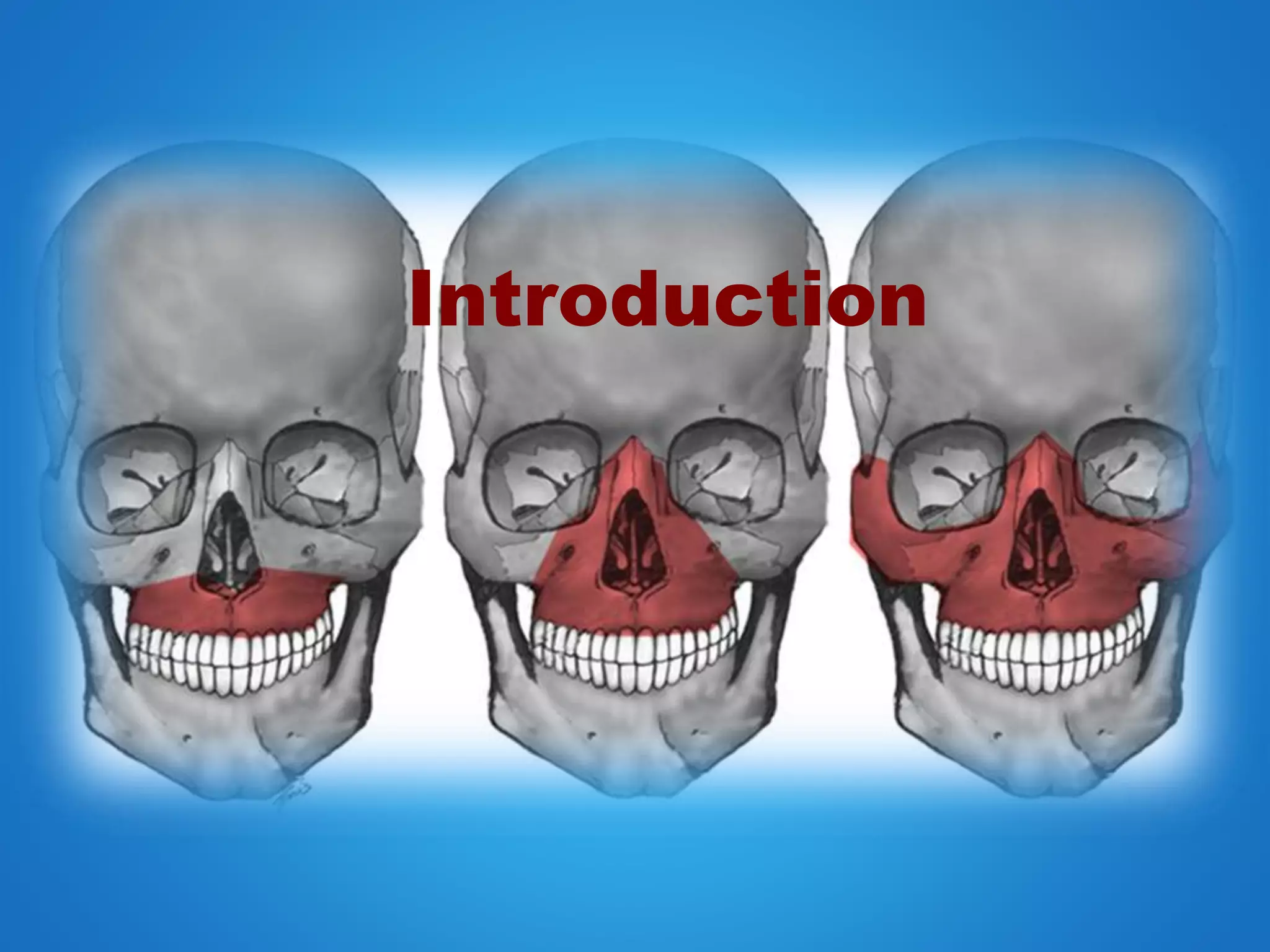 Lefort 1 osteotomy | PPTX