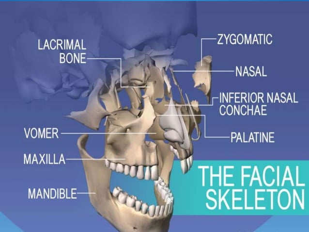 Lefort 1 osteotomy | PPTX | Bone and Joint Conditions | Diseases and ...
