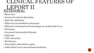 Lefort 2 fracture | PPTX