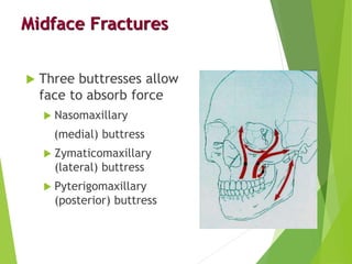 Lefort Fxs.pptx | Free Download