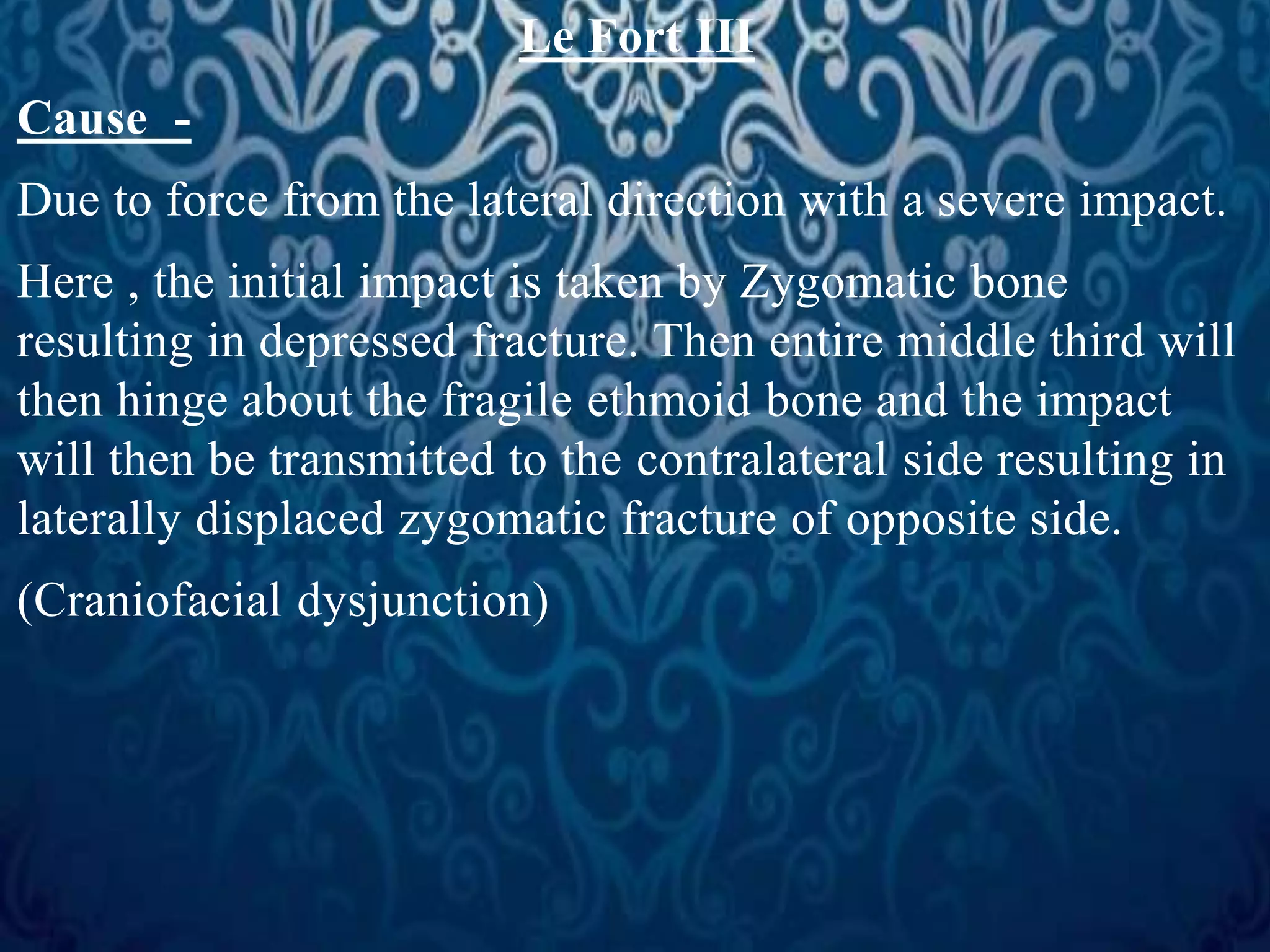 Le fort fracture by Dr. Amit T. Suryawanshi, Oral Surgeon, Pune | PPTX