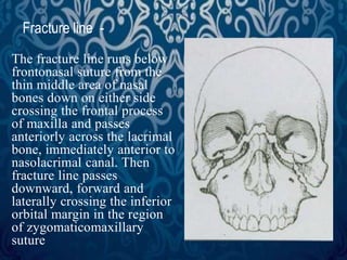 Frontonasal Junction