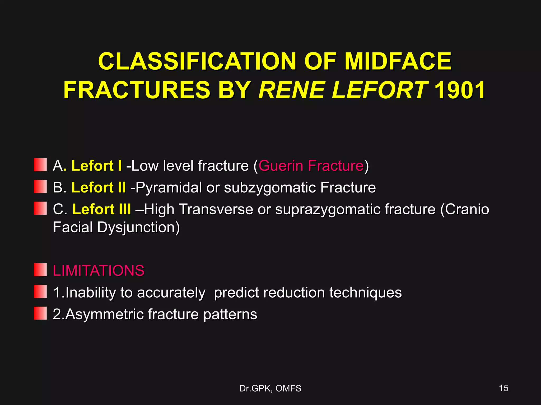 Le fort fractures | PPT