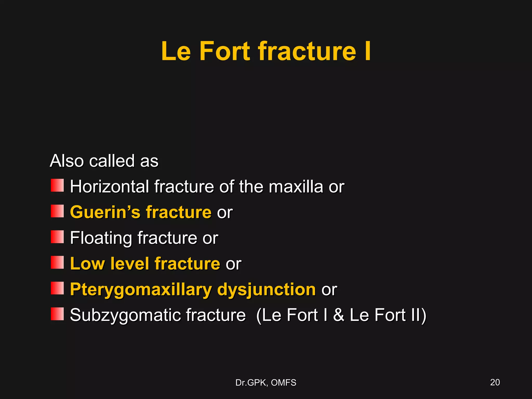 Le fort fractures | PPT