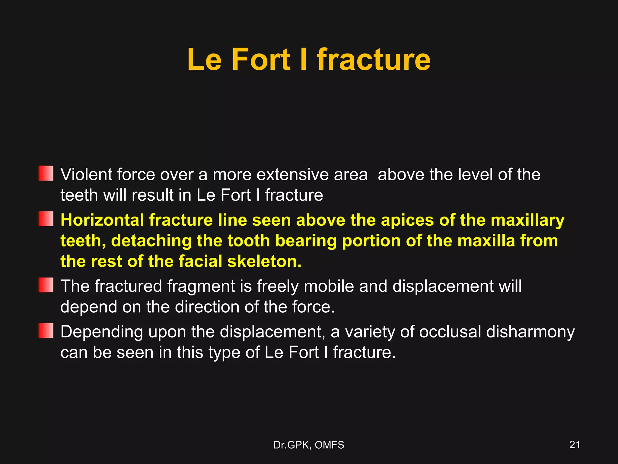 Le fort fractures | PPT