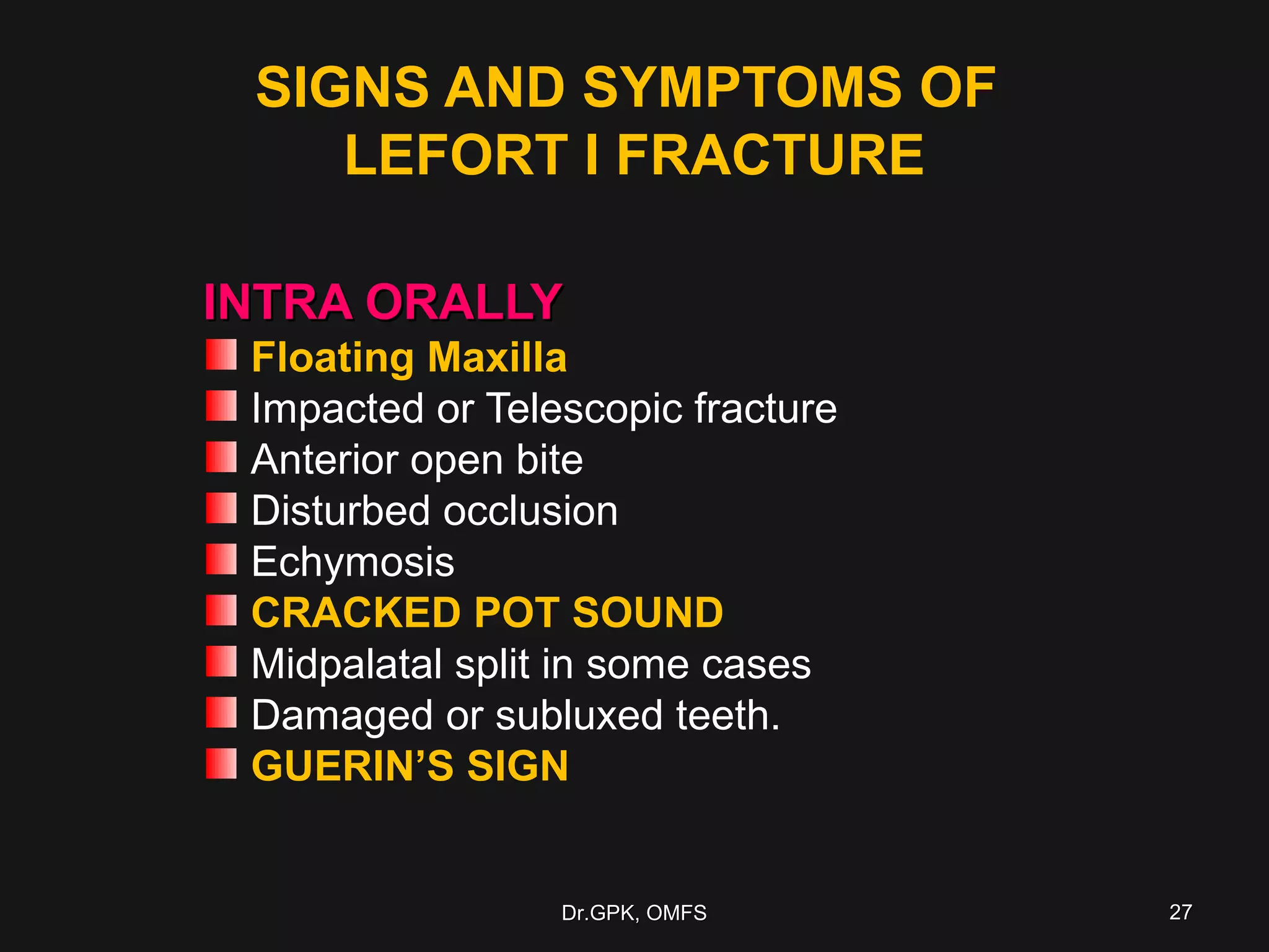 Le fort fractures | PPT