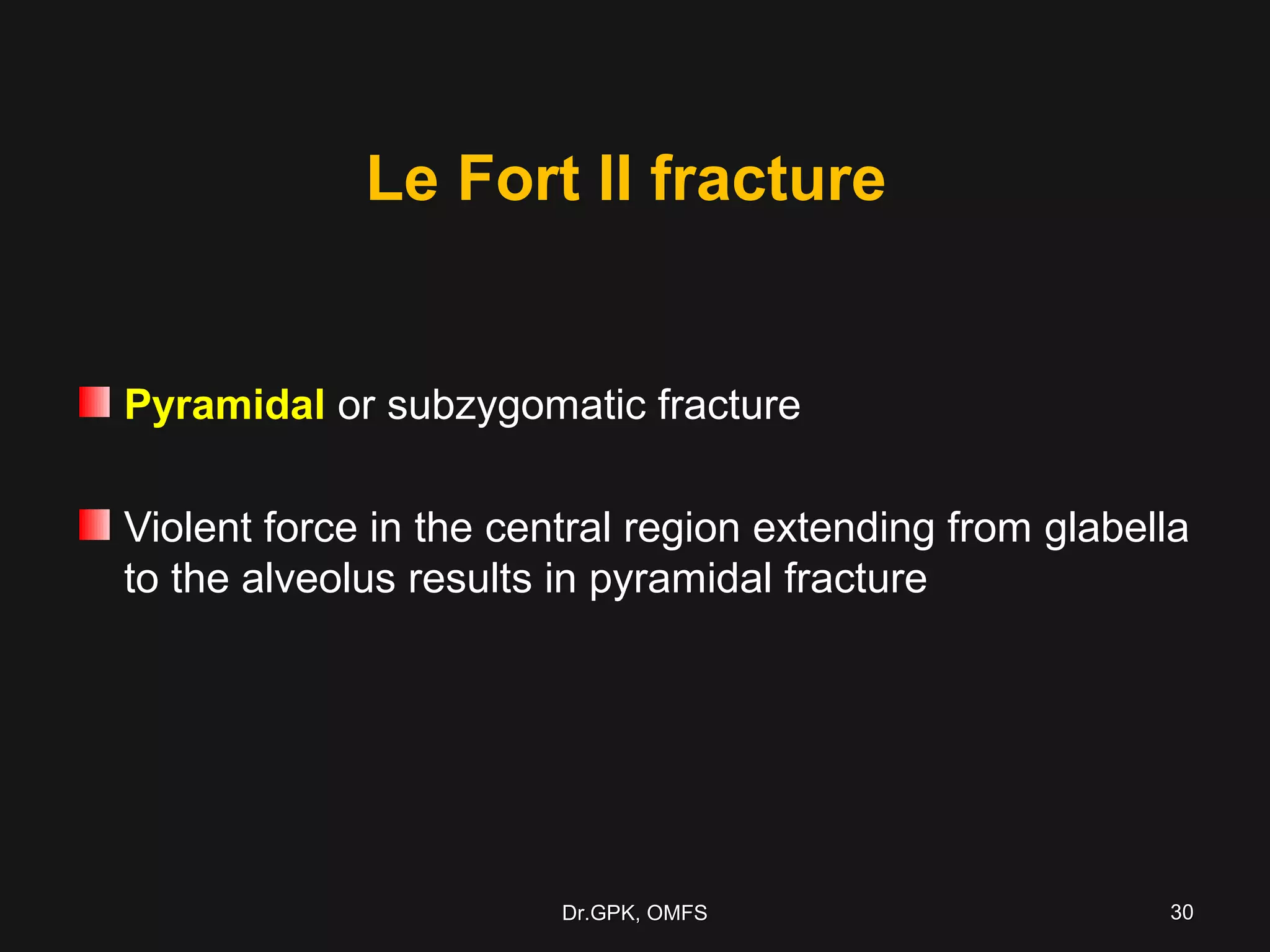 Le fort fractures | PPT