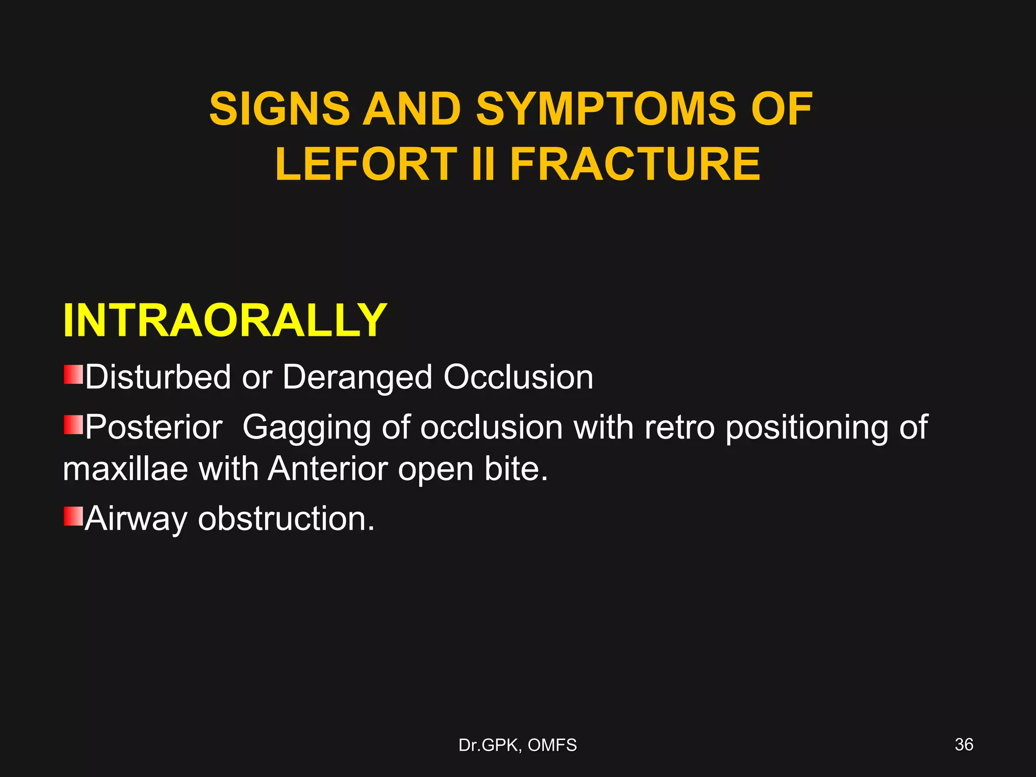 Le fort fractures | PPT