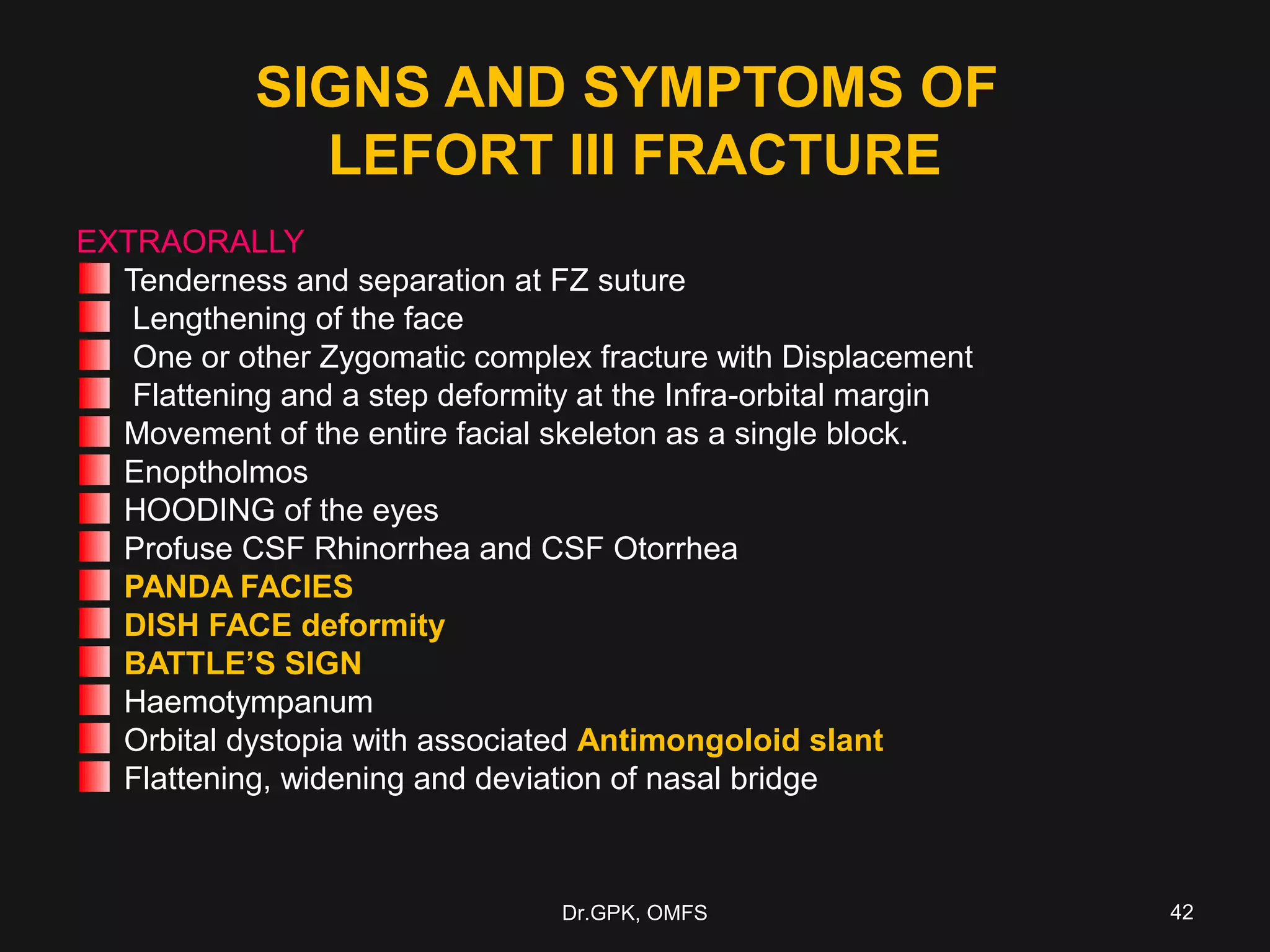 Le fort fractures | PPT