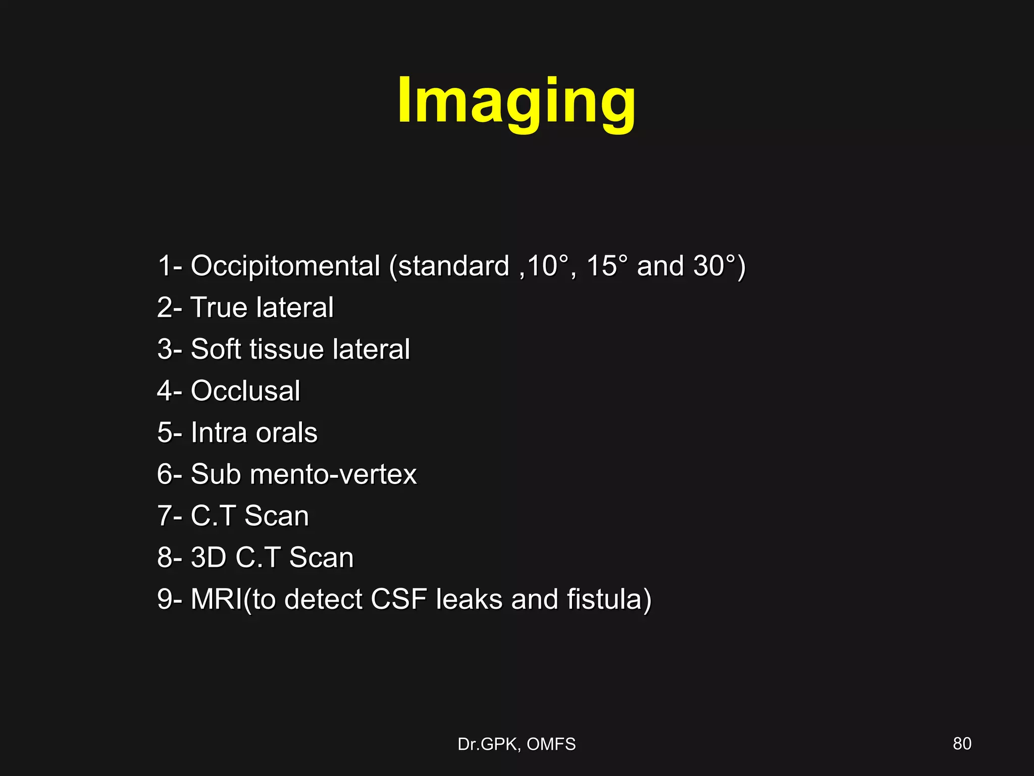 Le fort fractures | PPT