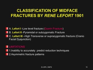 Le fort fractures | PPT