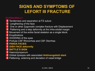 Le fort fractures | PPT