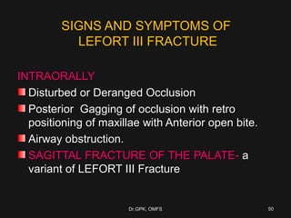 Le fort fractures | PPT