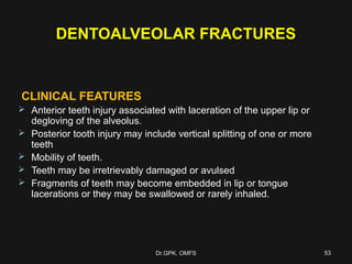 Le fort fractures | PPT