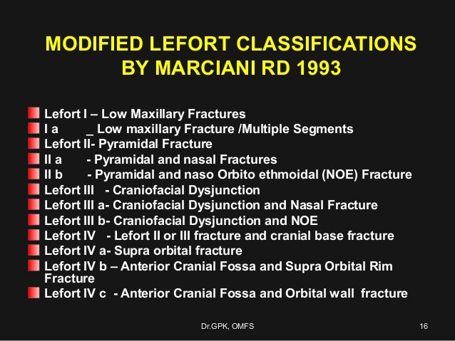 Le Fort Fractures