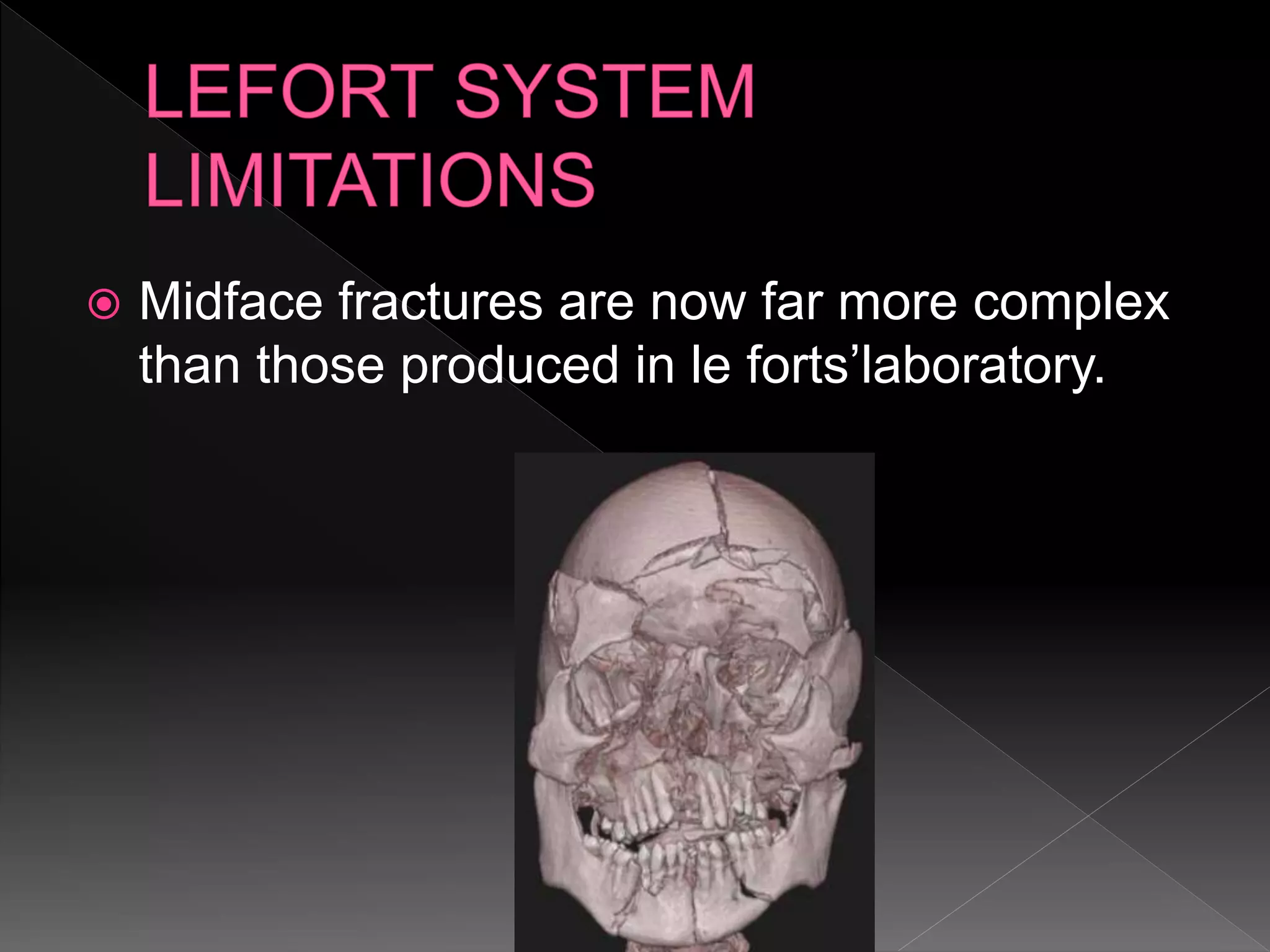 Lefort fractures | PPTX