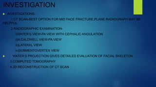 Lefort fractures | PPTX