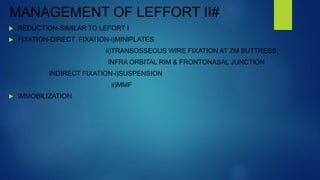 Lefort fractures | PPT