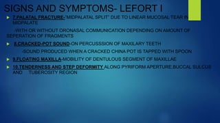 Lefort fractures | PPT