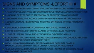 Lefort fractures | PPT