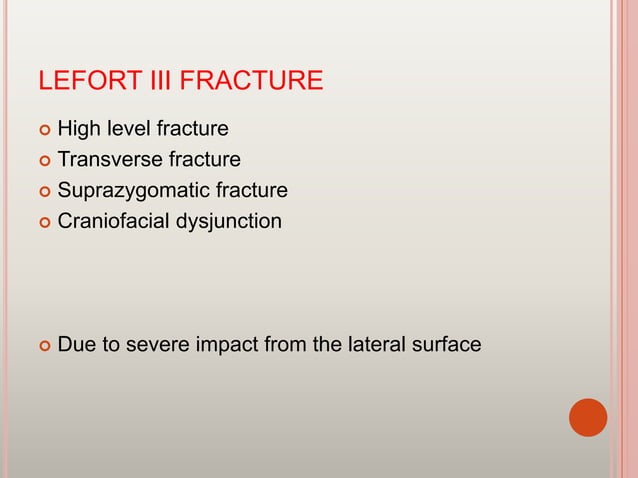 Lefort fractures | PPTX | Death, Injury, or Military Conflict ...